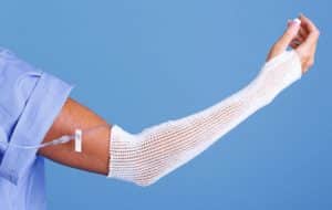Tubular Support-Compression Bandage (SpandaGrip™) | Medi-Tech ...