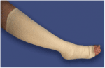 Tubular Support-Compression Bandage (SpandaGrip™) | Medi-Tech ...